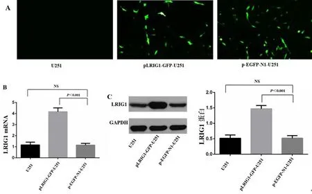 上调LRIG1对胶质瘤U251细胞侵袭、迁移的影响 - 临床神经论文